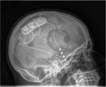 Care & Treatment | John R. Oishei Children's Hospital of Buffalo